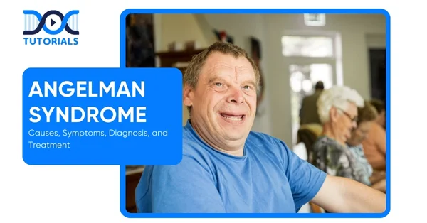 Angelman Syndrome | Causes, Symptoms, Diagnosis, and Treatment